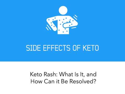 Keto Rash: What is it, and How Can it Be Resolved? | KetoDiet Blog