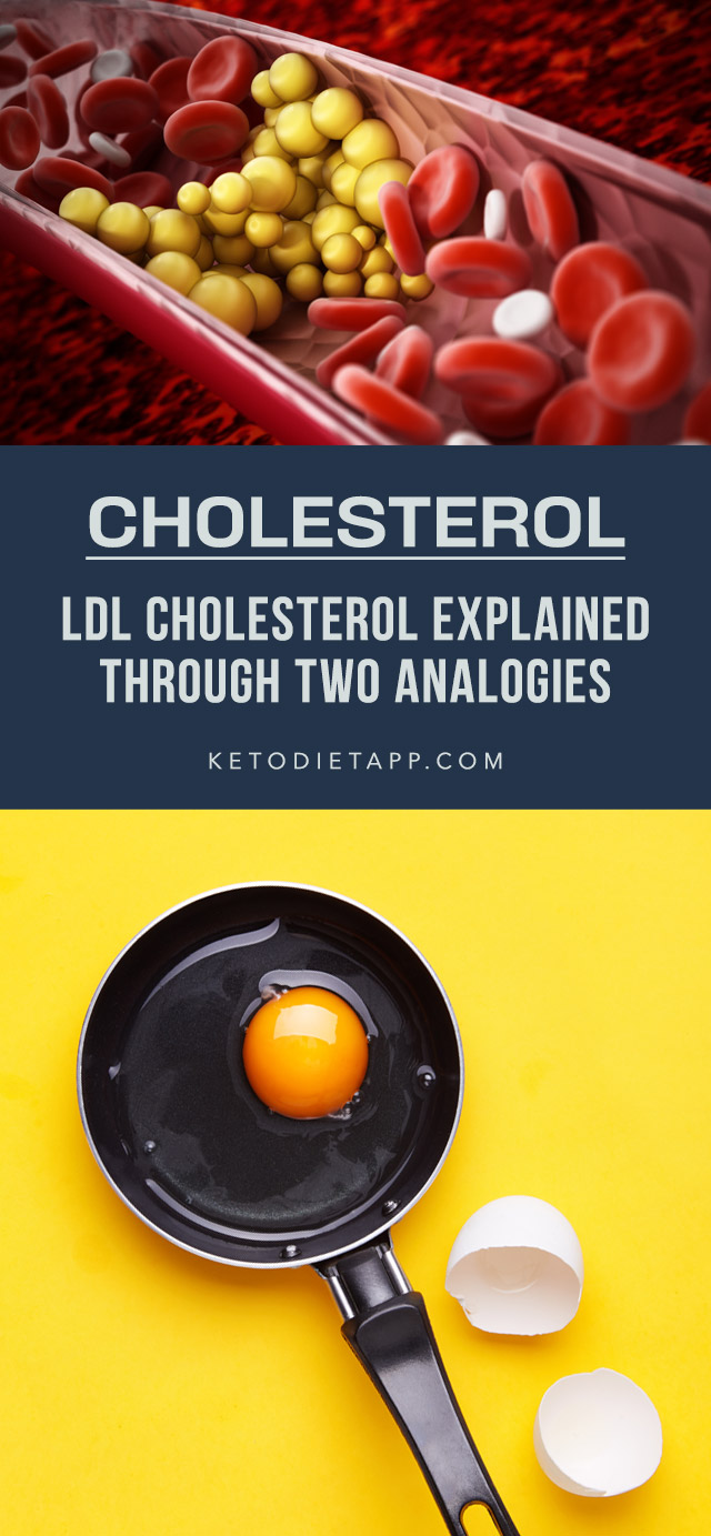 Understanding LDL-Cholesterol Through Analogies: Boats in Your ...